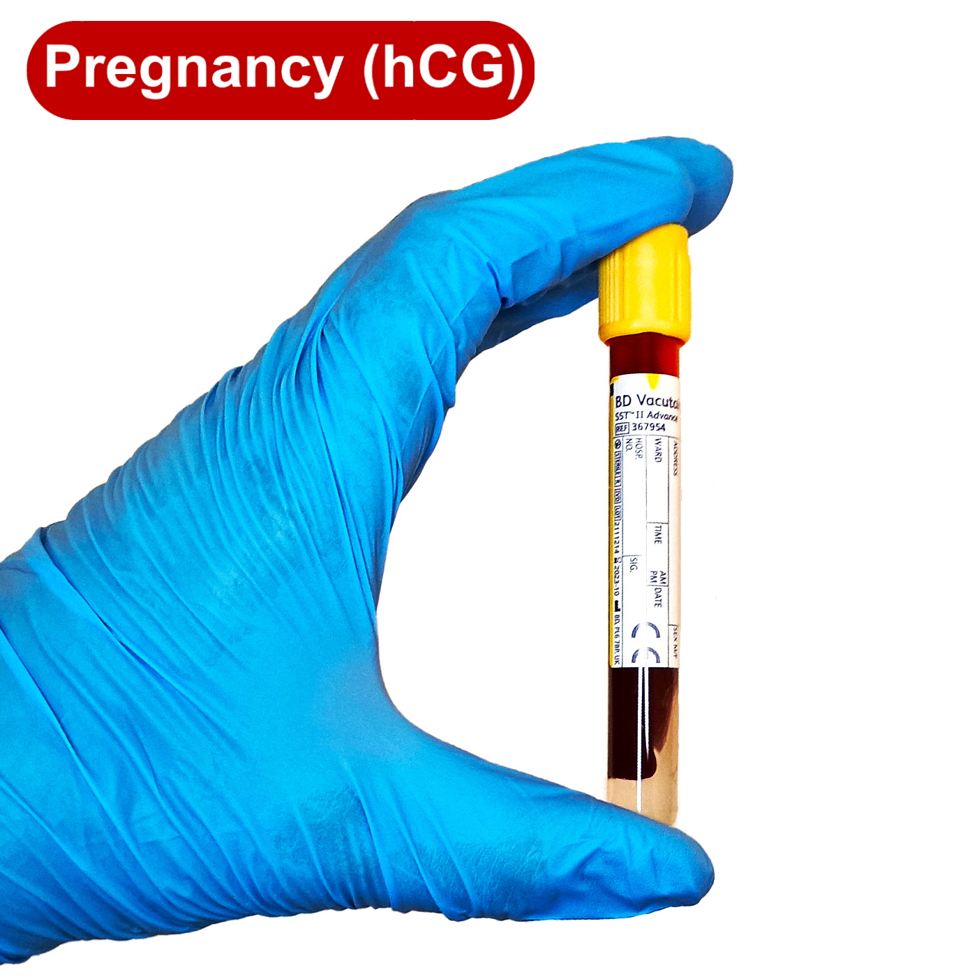 A Comprehensive Guide to Pregnancy Testing - Dr Amer Sheikh - Private GP